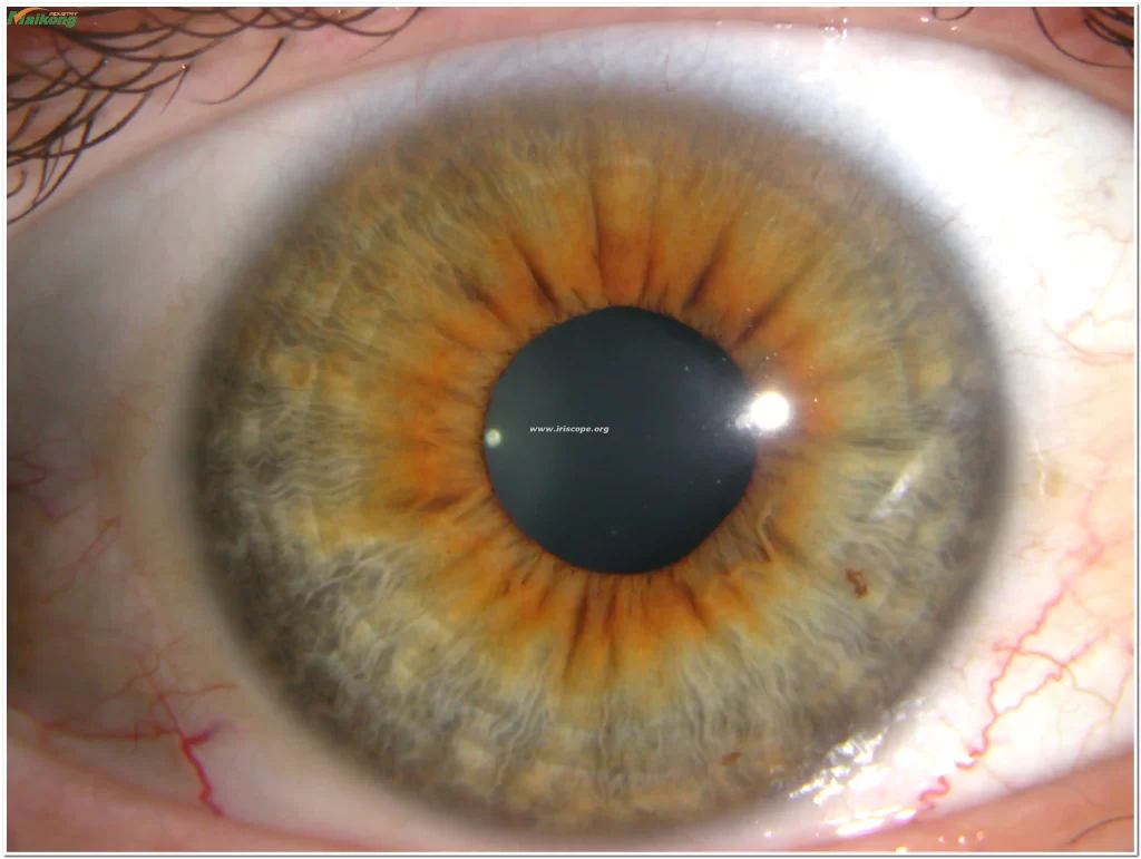 Iridology Chart How To Read – MAIKONG Iridology Chart